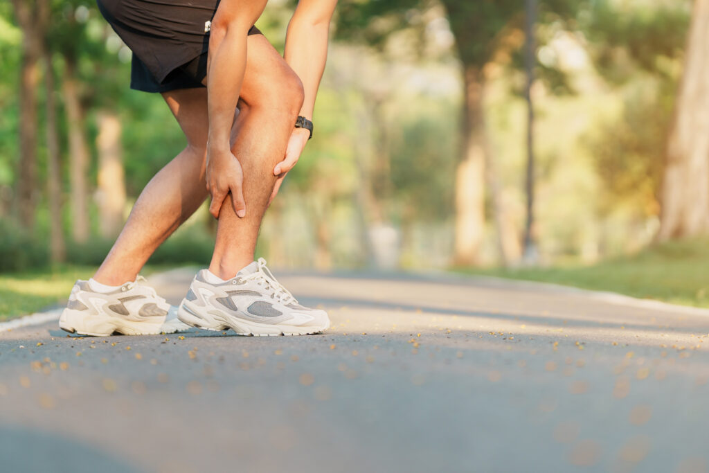 Everything You Need to Know About Spider Veins - Vantage Radiology